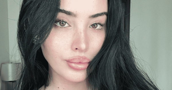 Thewizardliz Plastic Surgery: What Happened? Details About Her Family ...