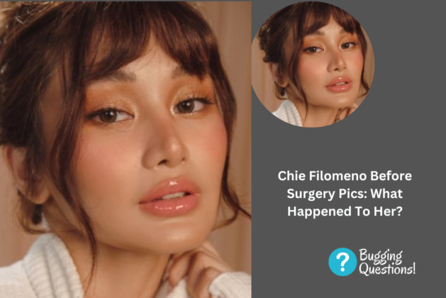 Chie Filomeno Before Surgery Pics: What Happened To Her? Age And Family ...