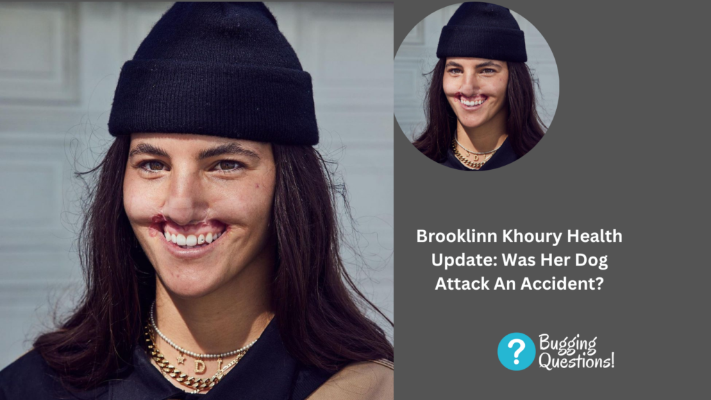 Brooklinn Khoury Health Update: Was Her Dog Attack An Accident? Know ...