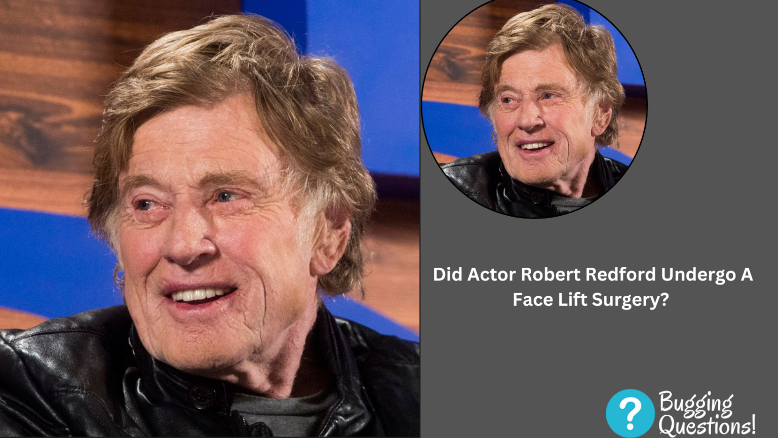 Did Actor Robert Redford Undergo A Face Lift Surgery? Before And After ...